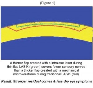 Bladeless Lasik Eye Surgery | Moretsky Cassidy LASIK Vision Correction ...